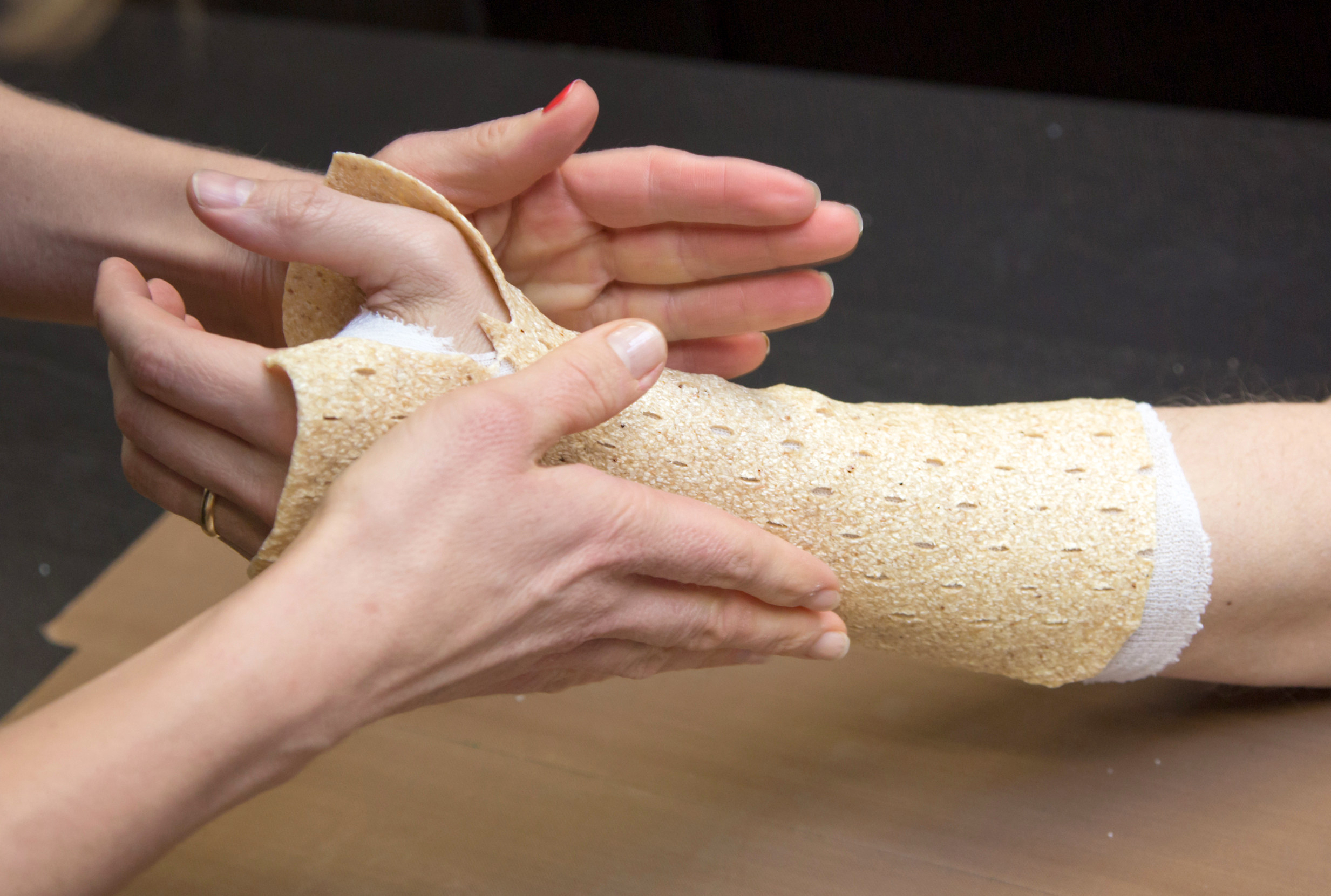 Murtuma paranee haavalla – Suomalainen puukipsi valloittaa maailmaa ...